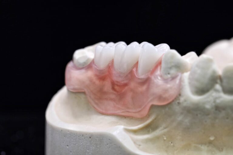 Dentures Leeds | Award-winning dentures in Leeds | HQ Dental